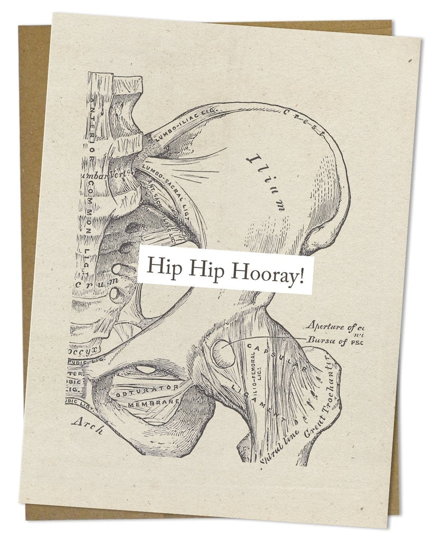 Hip Hip Hooray - Medical Graduation Card - Hip Replacement | Cognitive ...